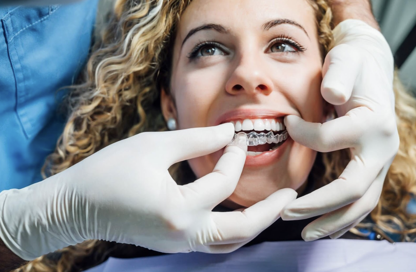 Understand the Invisalign Process Step-By-Step
